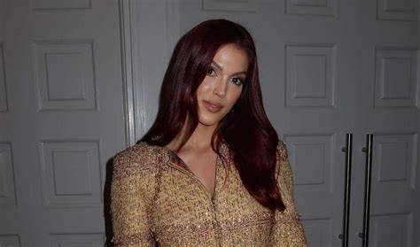 Iris Mittenaere Défigurée Elle Dévoile Son Visage Elle Est Méconnaissable