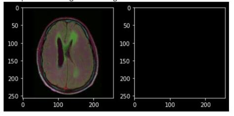 Web3byts On Linkedin Segmenting Brain Mri Images Using Python Tensorflow And Keras