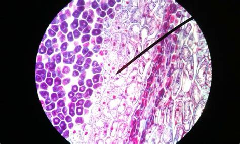 Rhizobium Bacteria Bacteria Flashcards