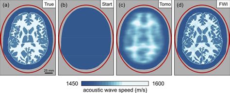 Full Waveform Inversion Imaging Of The Human Brain Biorxiv
