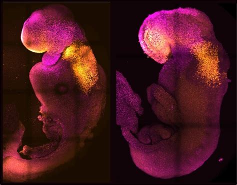 Synthetic” Mouse Embryo With Brain And Beating Heart Grown From Stem Cells
