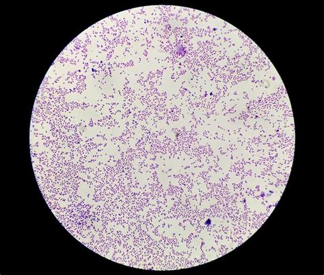 Staphylococcus Epidermidis Gram Stain