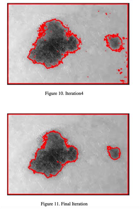 Image Segmentation Using Otsu Threshold Selection Method By Vignesh Gopalakrishnan Medium
