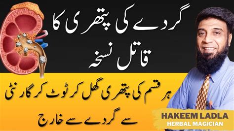 Gurde Ki Pathri Ka Ilaj Say Goodbye To Surgery Youtube