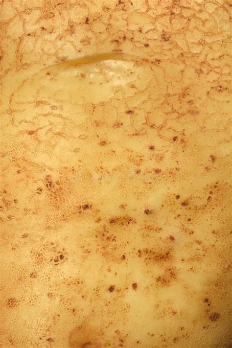 Raw Potato Skin Stock Image Image Of Potato Detail 393326745