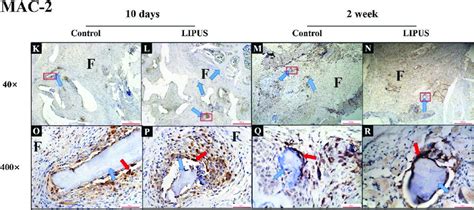 Immunohistochemical Staining For Mac 2 In The Control And Lipus Group