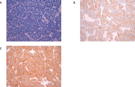 A Representative Image Of The Tumor Morphology Demonstrating Solid