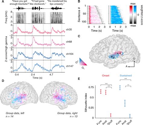 Figure 1 From A Spatial Map Of Onset And Sustained Responses To Speech