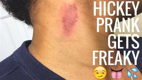 Hickey Prank On Boyfriend Gets Really Freaky Vlog Youtube