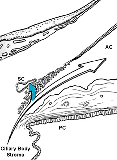 The Role Of The Ciliary Body In Aqueous Humor Formation Ocl