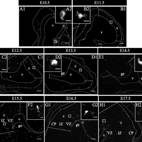 Proliferation In The Developing Mouse Embryonic Choroid Plexus Download Scientific Diagram