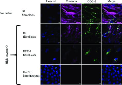 Immunofluorescence Staining Of Collagen 1 Col 1 By Vimentin Positive Download Scientific