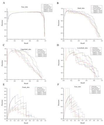 Improved YOLOv Tiny Based On Attention Mechanism For Skin Detection PeerJ