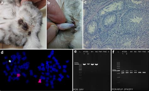 Characteristics Of Dsd Case 7355 A B Normal Male External