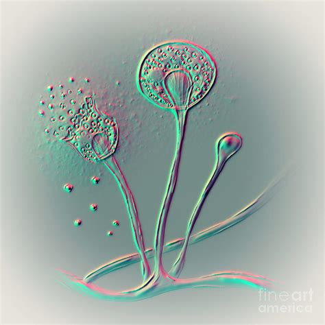 Mucor Under Microscope