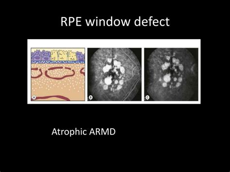 Ppt Ffa Powerpoint Presentation Free Download Id3619279