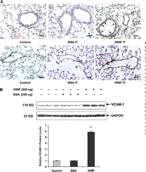 Figure 1 From Hypoxia Induced Mitogenic Factor Promotes Vascular Adhesion Molecule 1 Expression