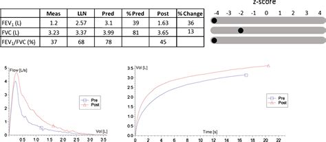 Spirometry Copd Values At Kelley Bishop Blog