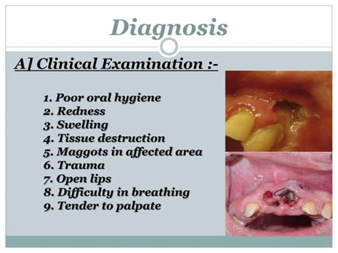 Oral Myiasis Pptx