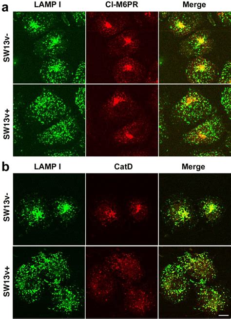 Cation Independent Mannose 6phosphate Receptor Distribution Is Not