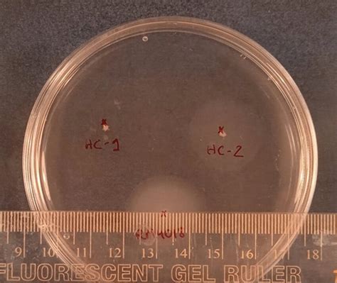 Representative Image Obtained From The Motility Assay Strains Rm4018