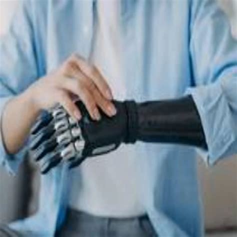 Lower Limb Elbow Joint Prosthesis At ₹ 350000piece In Lucknow Id