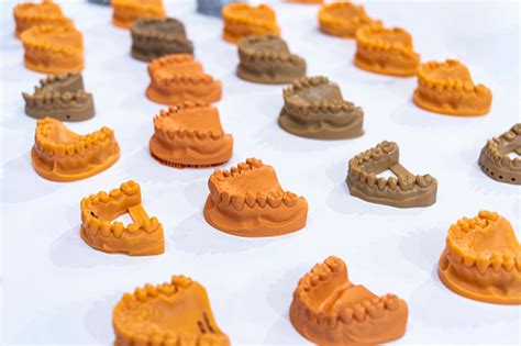 실험실에서 3d 프린터에서 치아 생산을 위한 모델링 프레임 3차원 형태에 대한 스톡 사진 및 기타 이미지 3차원 형태 사람 이빨 컴퓨터 프린터 Istock