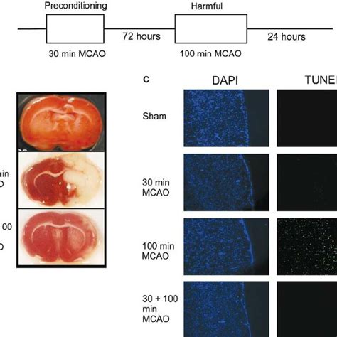 Preconditioning The Brain With Mild Ischemia Results In The Brain Being