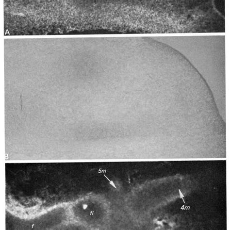 Immunofluorescent Localization Of Fibronectin During Chick Limb Bud Download Scientific Diagram