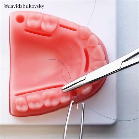 Simple Interrupted Suture In Dentistry Used Mainly For Single Tooth