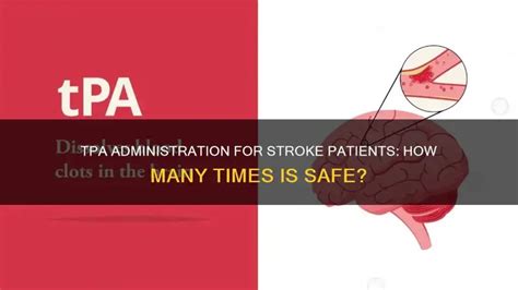 Tpa Administration For Stroke Patients How Many Times Is Safe MedShun