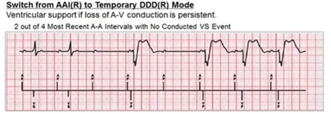 Brady Pacemaker Features Flashcards Quizlet