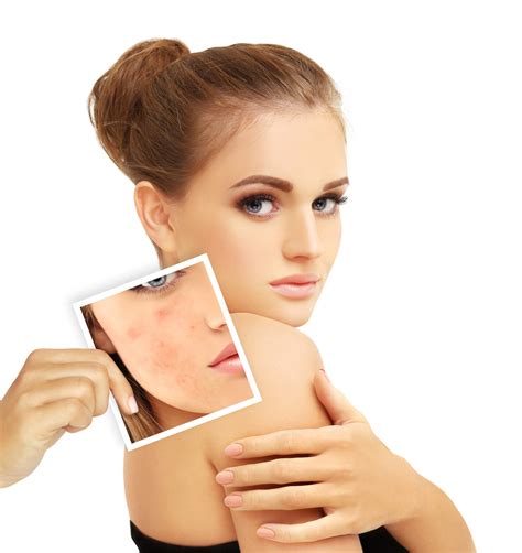 Patch Testing Knott Street Dermatology