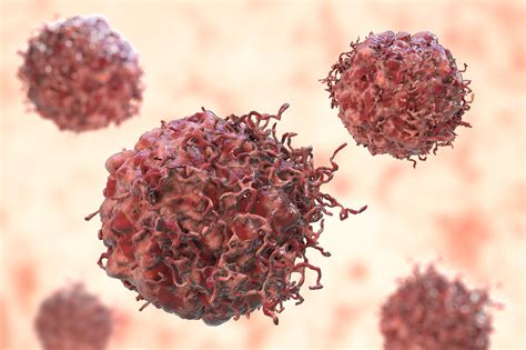 Gut Defenders How T Cell Intraepithelial Lymphocytes Guard Against Colon Cancer