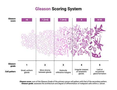 Gleason Scoring System Biorender Science Templates