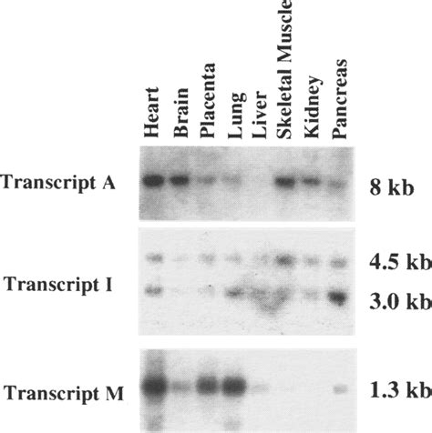 Expression Pattern Of Selected Transciption Units Hybridization Of
