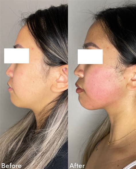 Reviews Rated R Esthetics