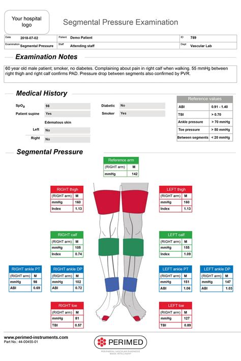Segmental Pressures An Initial Indication Of Arterial Occlusive Lesions