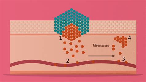Circulating Tumor Cells Detection And Applications Technology Networks
