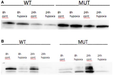 A P53 Protein Expression Under Hypoxic Conditions And Control In Tp53 Download Scientific