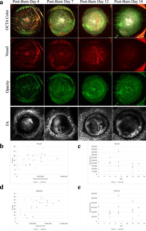 A The Octa And Fa Data Show Neovascularization Progression Over Time Download Scientific