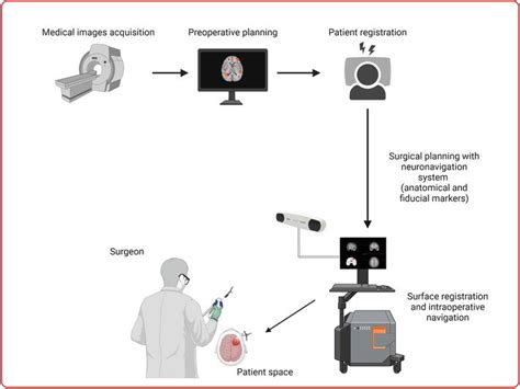 Neuronavigation Neuroimaging Applied To Neuromodulation And Neurosurgery Intechopen