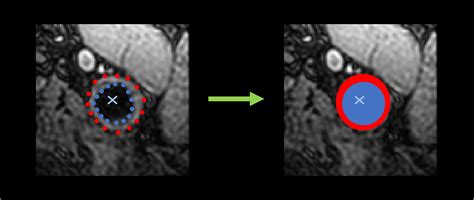 voxel mask segmentation carotid segmentation documentation