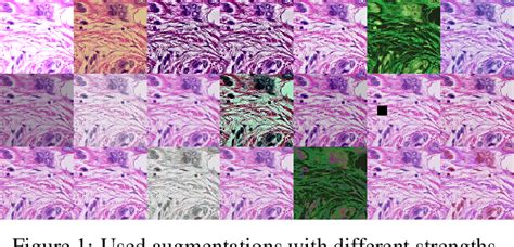 Mitodet Simple And Robust Mitosis Detection