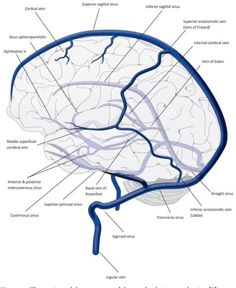 Pdf Endovascular Treatment Of Intracranial Vein And Venous Sinus