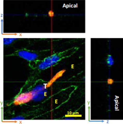 Tumor Cell Red Labeled T Transmigration Through The Junction