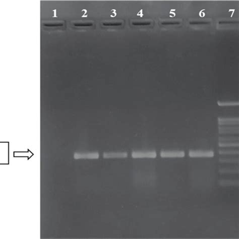Phenotypic Confirmation Of Esbl Production Of E Coli Isolate Download Scientific Diagram
