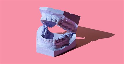 Dry Socket Symptoms Causes Prevention Treatment Tips