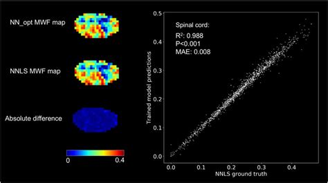 Comparison Of Spinal Cord Mwf The Mwf Maps Of A Healthy Spinal Cord