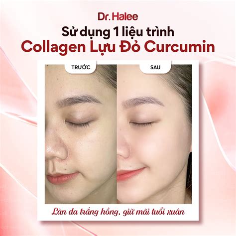 Collagen Lựu đỏ Curcumin Phiên Bản Hộp 30 Gói Dr Halee